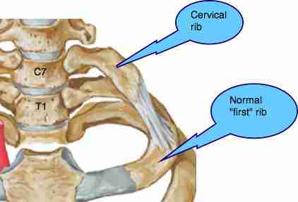 Symptoms of whiplash describes the mechanics and symptoms after trauma